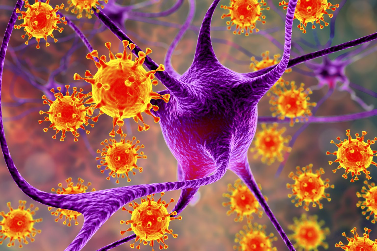 Meningitis: Bug of the Month - Pathogend of New Jersey - Safe Spaces